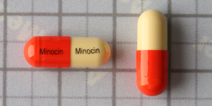 미노씬 캡슐 [50mg] ( Minocin cap [50mg]) | 의약품정보 | 의료정보 | 건강정보 | 서울아산병원