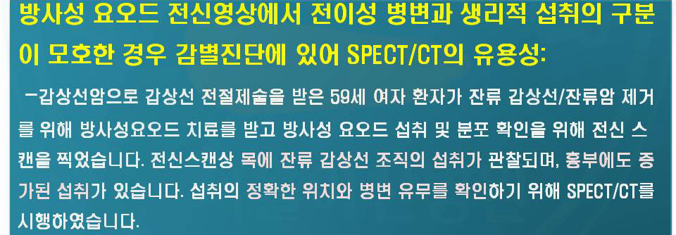 Case Conference 갑상선암 수술 후 방사성요오드 치료 경과를 확인하기 위해 내원한 59세 여자 환자 핵의학