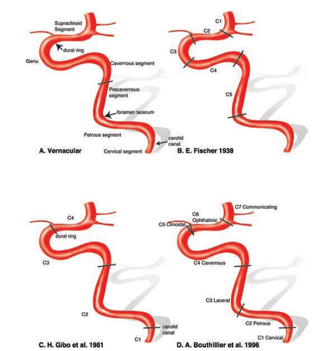 내경 동맥 다양한 해부학적 분류 (ICA segment anatomy) | 신경중재최근동향 | 커뮤니티 | 신경중재클리닉 ...