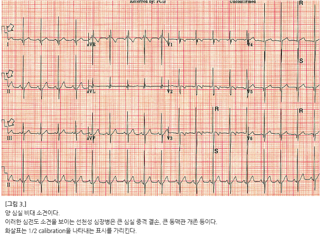 심장검사 선천성심장병이란 심장질환정보 선천성심장병센터 서울아산병원