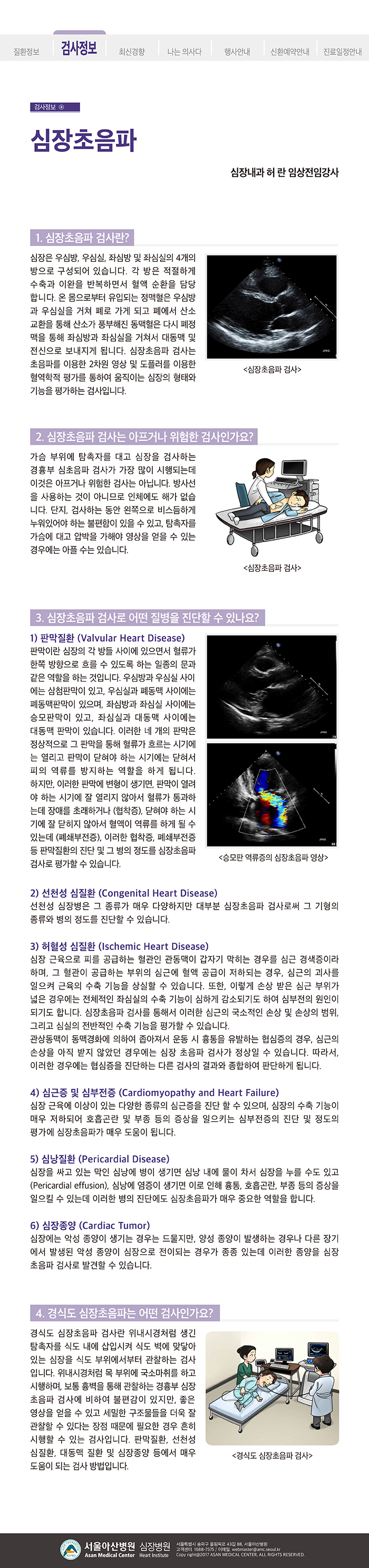 아산심장소식지 2017년 여름호 심장초음파 검사 아산심장소식지 일반인정보 심장병원 서울아산병원