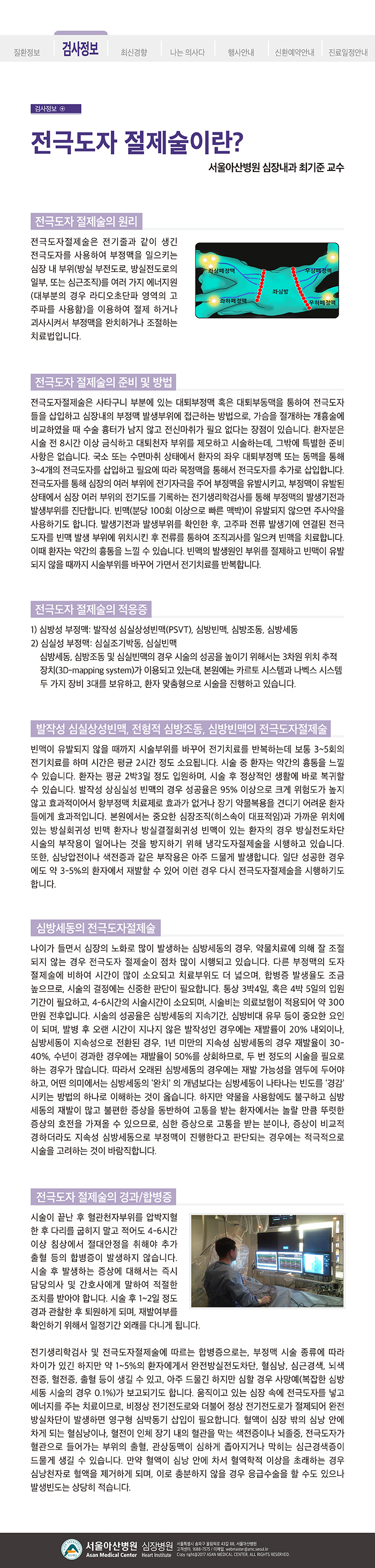 아산심장소식지 2017년 겨울호 전극도자 절제술 아산심장소식지 일반인정보 심장병원 서울아산병원