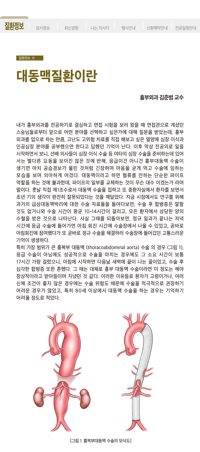 아산심장소식지 2018년 겨울호 대동맥질환이란 아산심장소식지 일반인정보 심장병원 서울아산병원