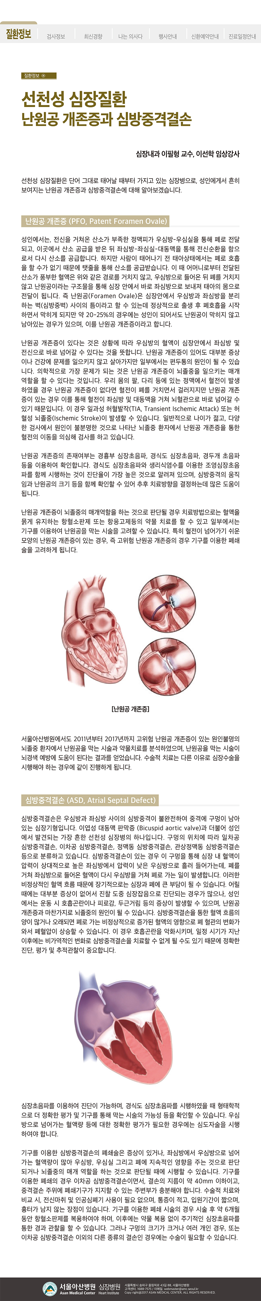 아산심장소식지 2019년 여름호 선천성 심장질환난원공 개존증과 심방중격결손 아산심장소식지 일반인정보 심장병원
