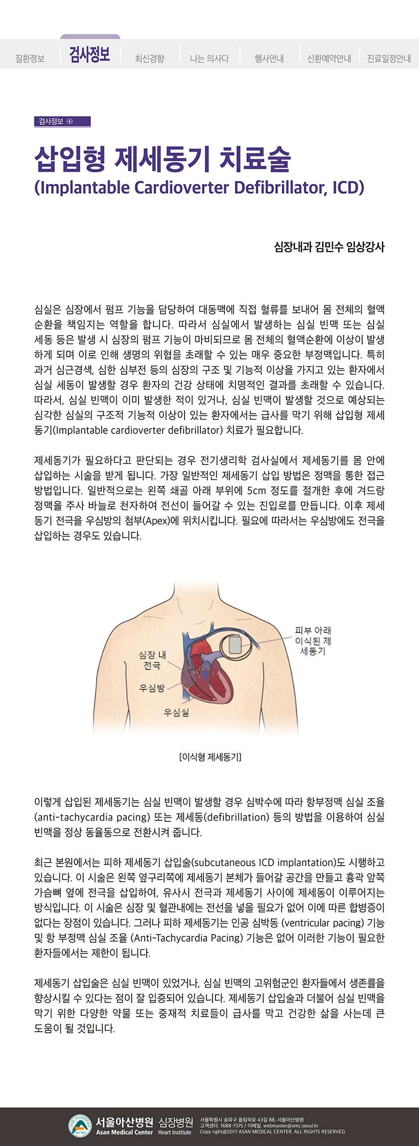 아산심장소식지 2019년 가을호 삽입형 제세동기 치료술 아산심장소식지 일반인정보 심장병원 서울아산병원