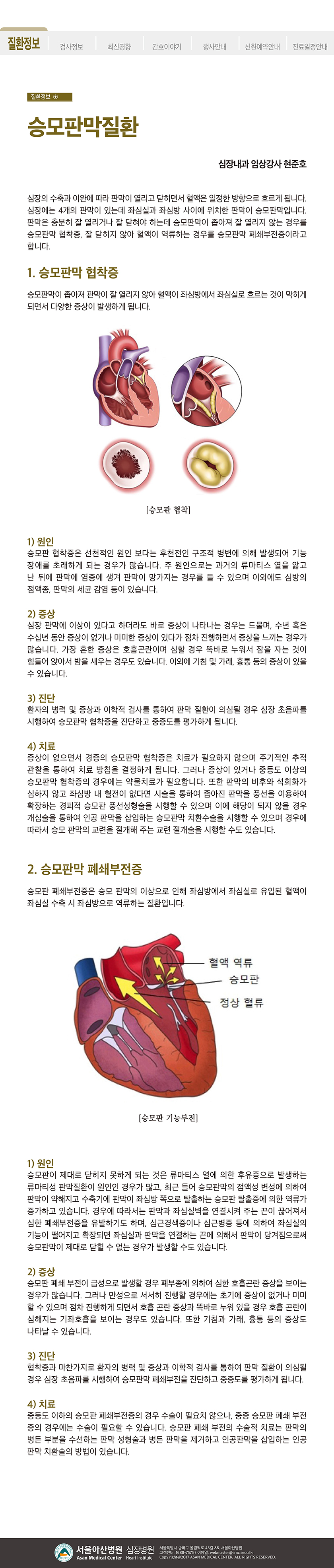 아산심장소식지 2020년 봄호 승모판막질환 아산심장소식지 일반인정보 심장병원 서울아산병원