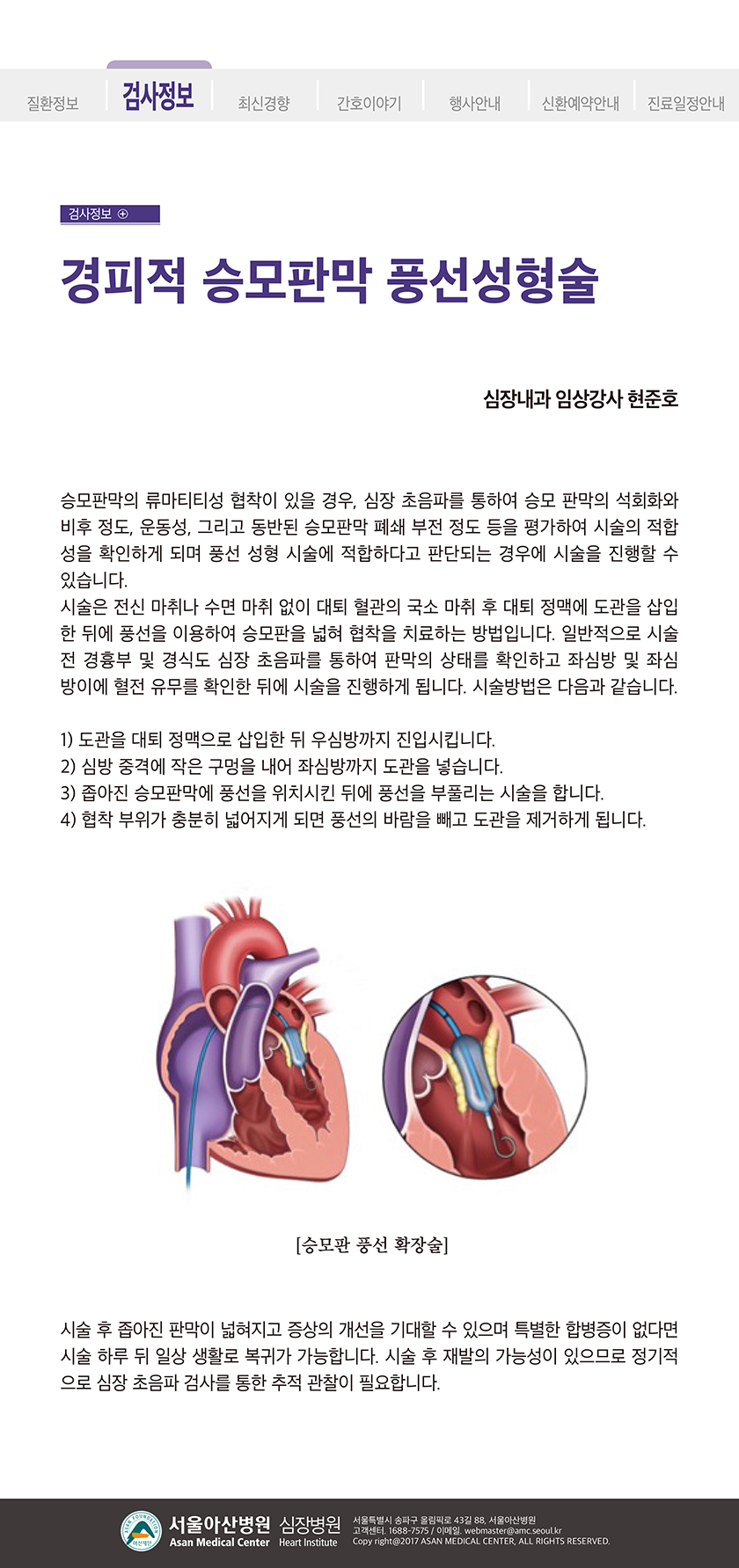 아산심장소식지 2020년 봄호 경피적 승모판막 풍선성형술 아산심장소식지 일반인정보 심장병원 서울아산병원