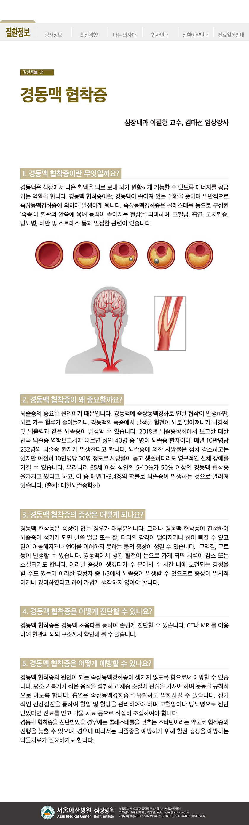 아산심장소식지 2021년 여름호 경동맥 협착증 아산심장소식지 일반인정보 심장병원 서울아산병원