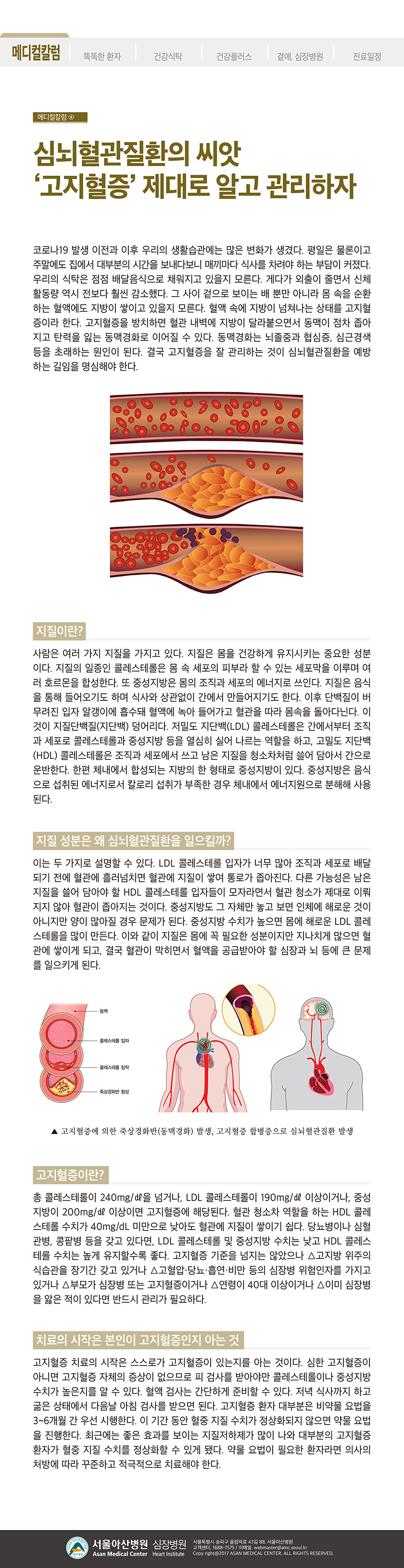 아산심장소식지 2023년 여름호 메디컬칼럼 아산심장소식지 일반인정보 심장병원 서울아산병원